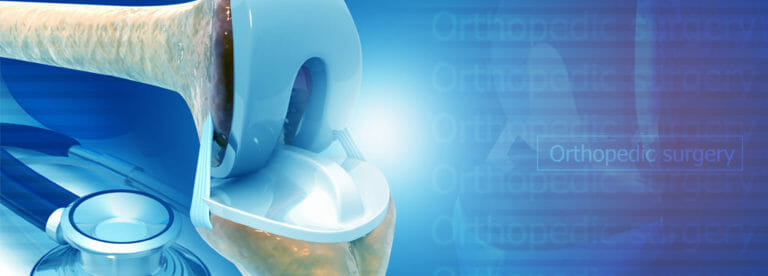 ASTM F384 Angled Orthopedic Device Fixation Testing - Applied Technical ...