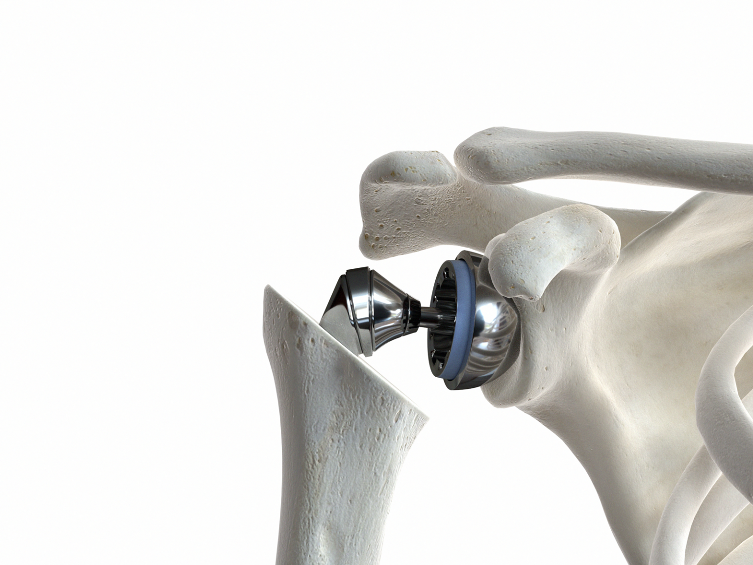 ASTM F1378 Shoulder Prostheses Testing