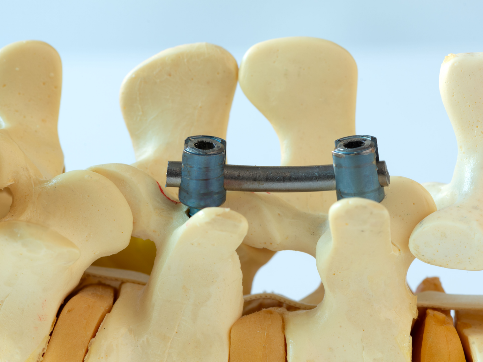 ASTM F2077 - Applied Technical Services